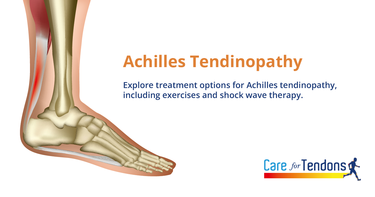 Achilles Tendinopathy: Treatments, Exercises & Recovery Tips