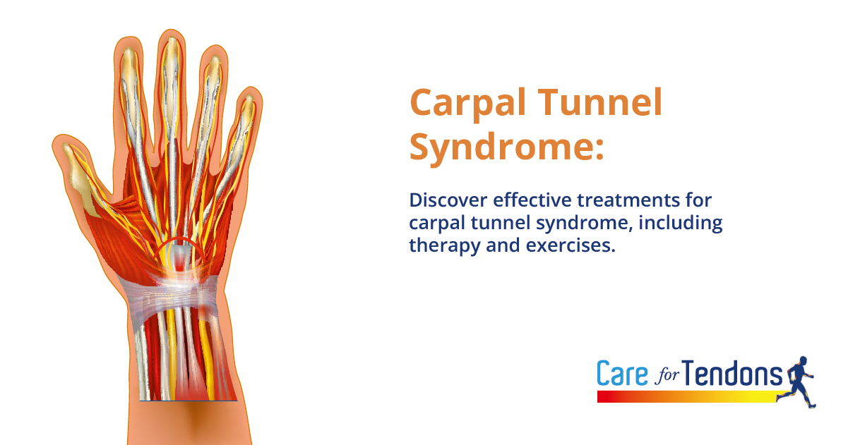 Carpal Tunnel Syndrome: Causes, Symptoms & Treatment Options