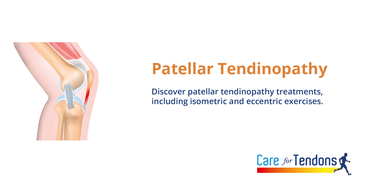 Patellar Tendinopathy: Causes, Symptoms & Recovery Exercises