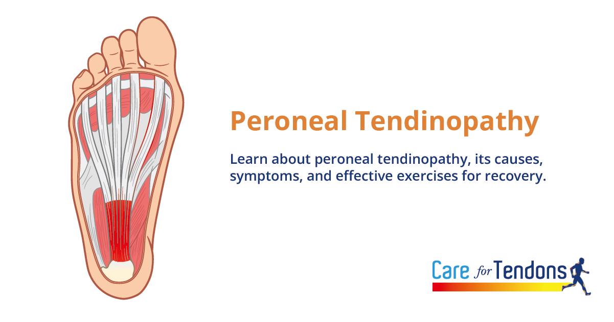 Peroneal Tendinopathy: Causes, Symptoms & Exercise Solutions