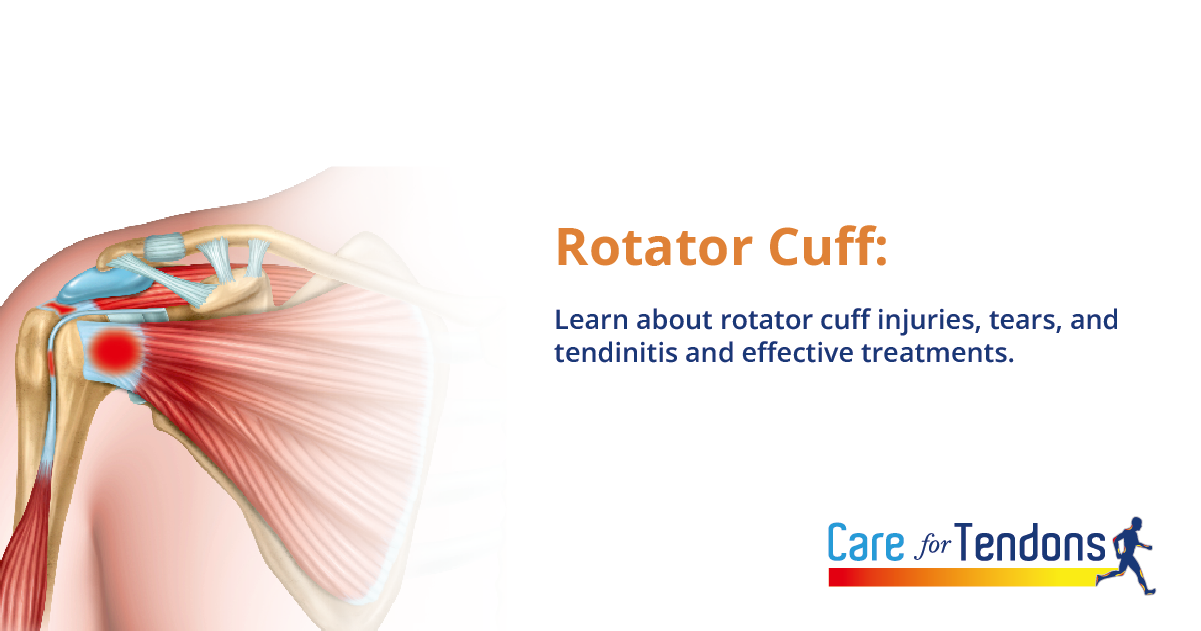 Rotator Cuff: Injuries, Treatments & Strengthening Exercises