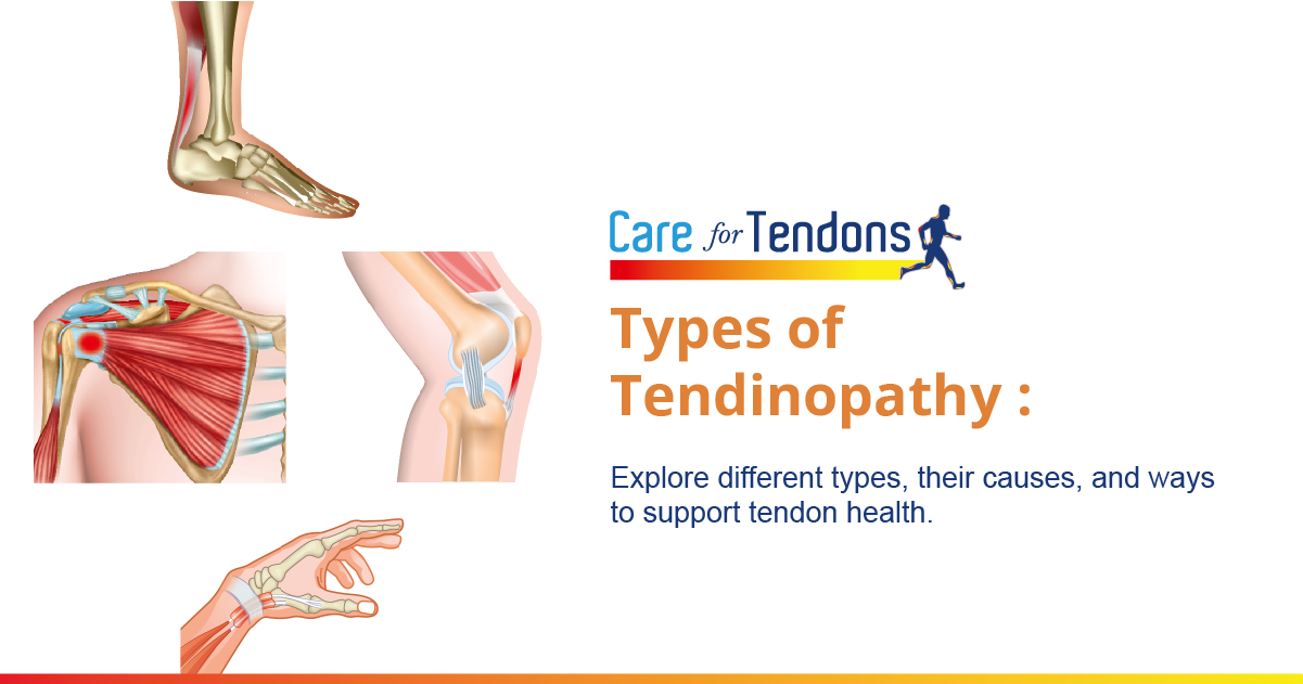 Explore Top Types of Tendinopathy | Care for Tendons